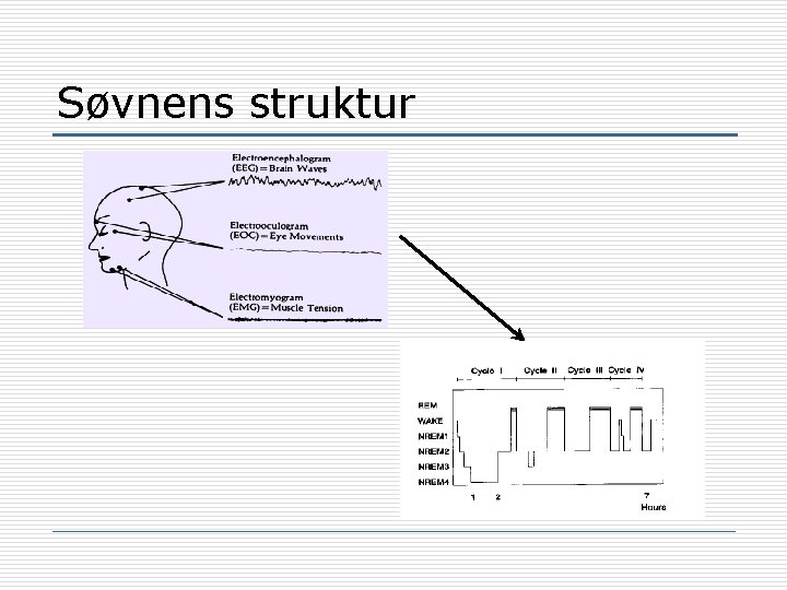 Svnproblemer og RLS Poul Jennum Professor overlge dr