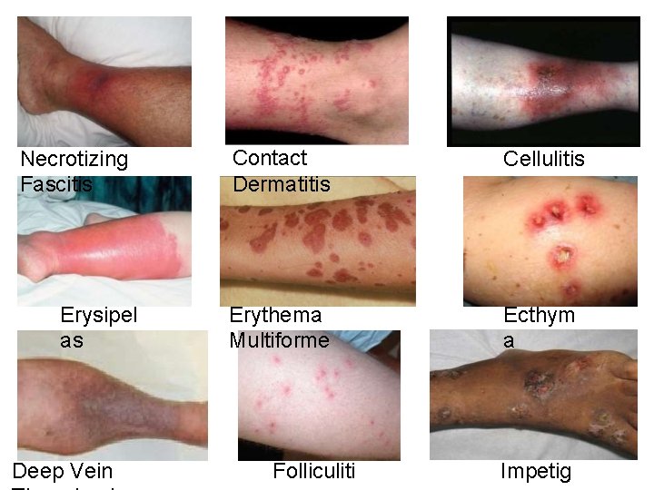 Skin Soft Tissue Infections Anatomy of the Skin