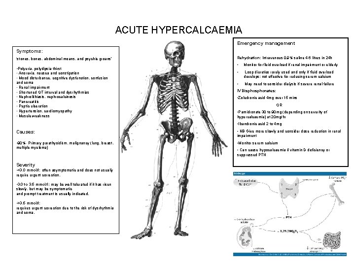 ACUTE HYPERCALCAEMIA Emergency management Symptoms stones bones abdominal