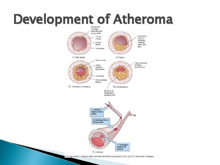Cardiovascular Disorders Mr Tsigaridis Overview Diagnostic Tests for