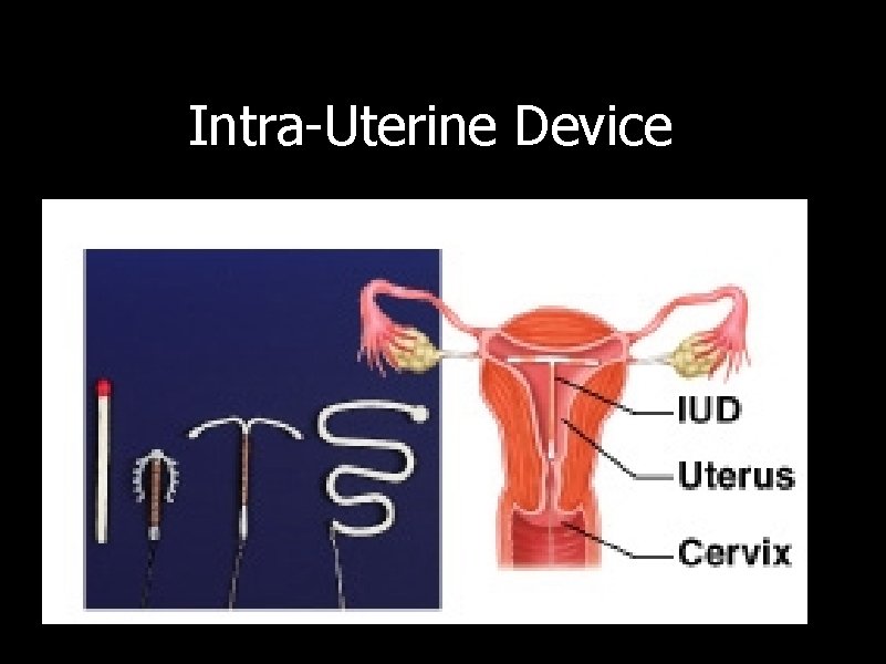 The Goal of Birth Control Is the Prevention