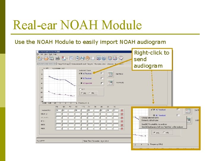 Introduction to the 7000 Hearing Aid Test System