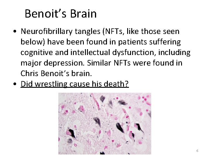 Rough Games and the Brain The Structure and