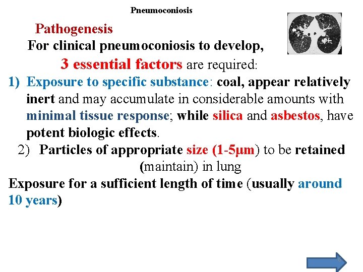 Pneumoconiosis Prof DR Waqar Al Kubaisy 1 Occupational