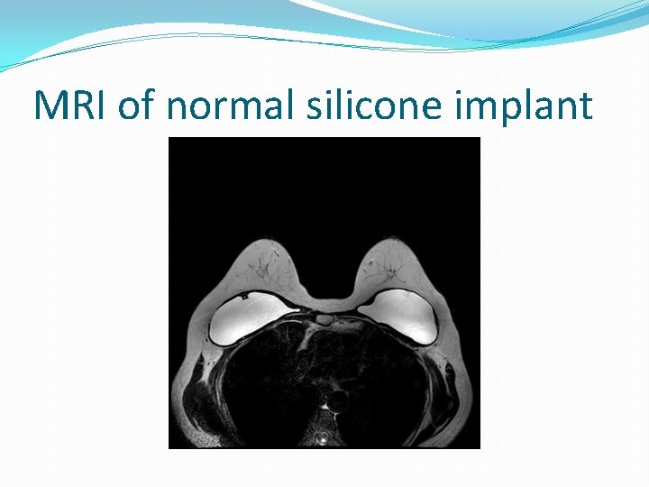 Sonography of the Breast Part III Lecture 10