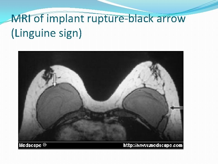 Sonography of the Breast Part III Lecture 10