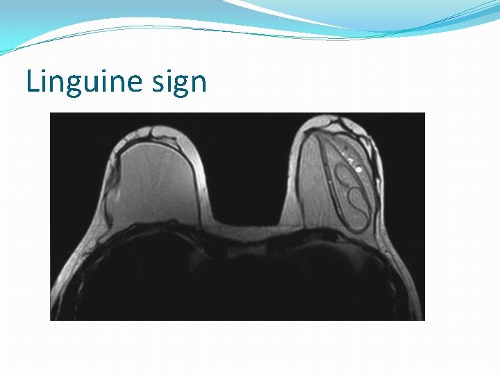 Sonography of the Breast Part III Lecture 10
