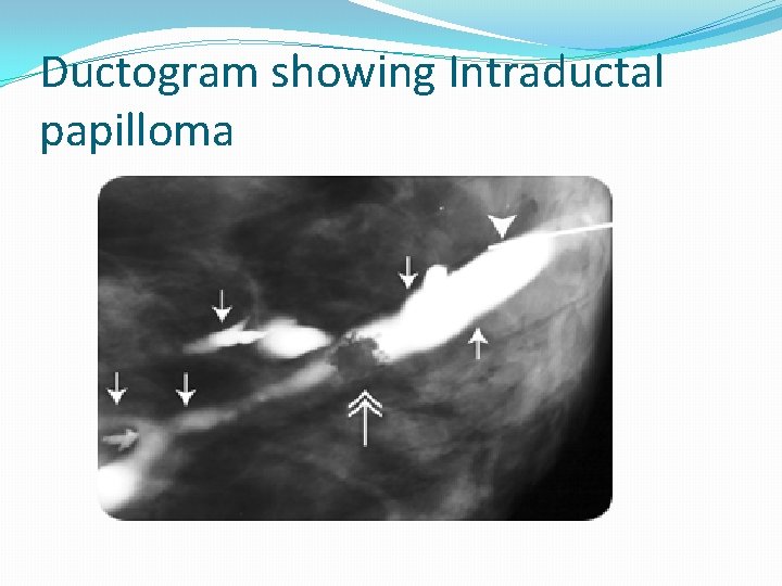 Sonography of the Breast Part III Lecture 10