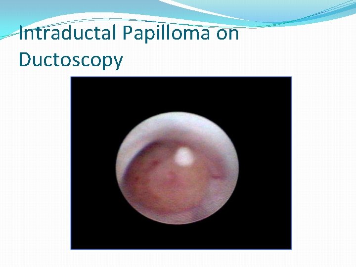 Sonography of the Breast Part III Lecture 10