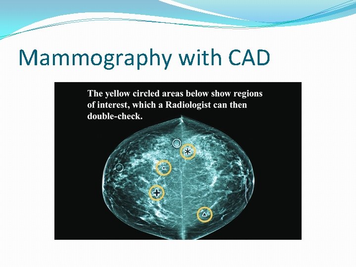Sonography of the Breast Part III Lecture 10