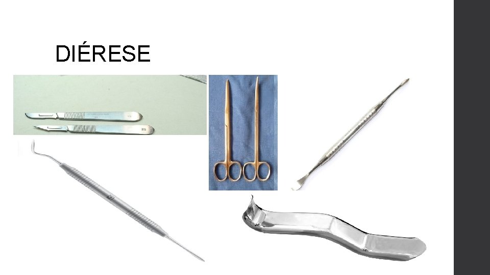 PRINCIPIOS CIRURGICOS DEFINIO Uma interveno cirrgica consiste em