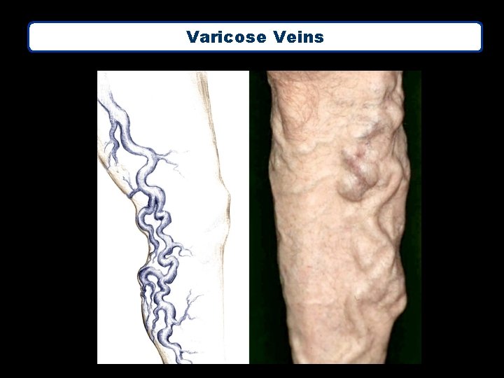 Blood and Blood Vessels Red Blood Cells and