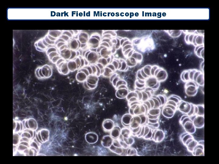 Blood and Blood Vessels Red Blood Cells and