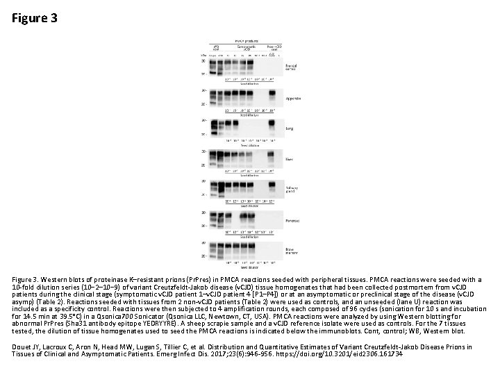 Figure 3 Western blots of proteinase Kresistant prions