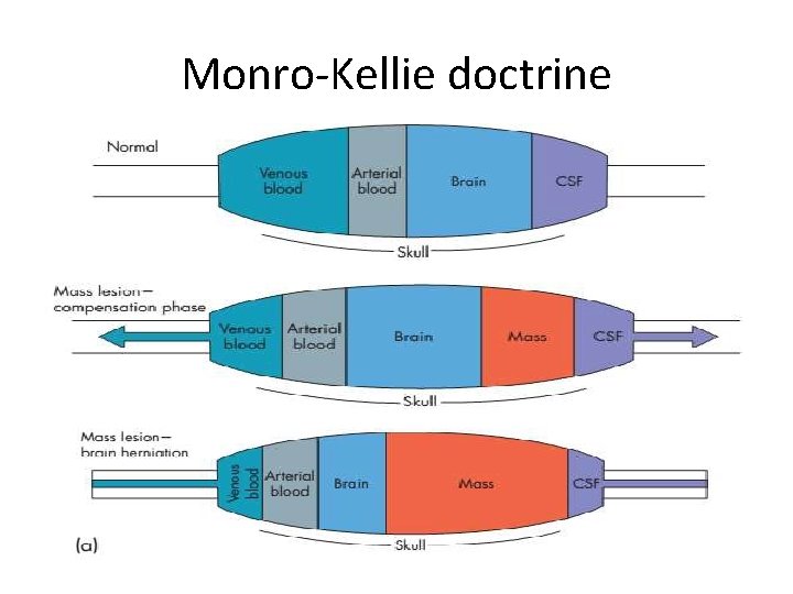 HEAD INJURY Dr Tariq Aladwan MRCS MD Mutah