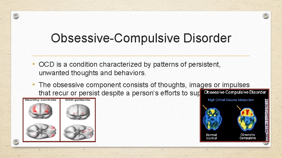 Anxiety Disorders Abnormal Psychology Mr Quirion Anxiety What