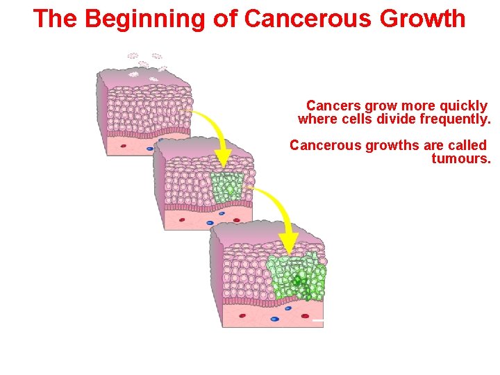 The Cell Cycle and Cancer Checkpoints in the