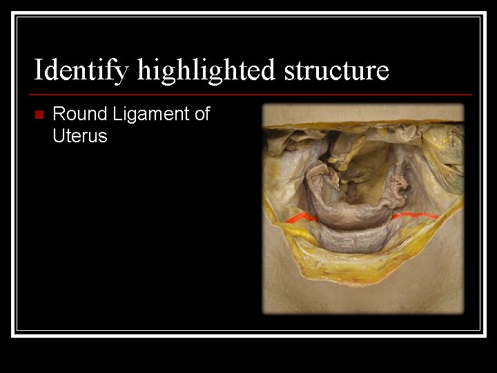 Reproductive Lab Review Game Spring 2018 Identify highlighted