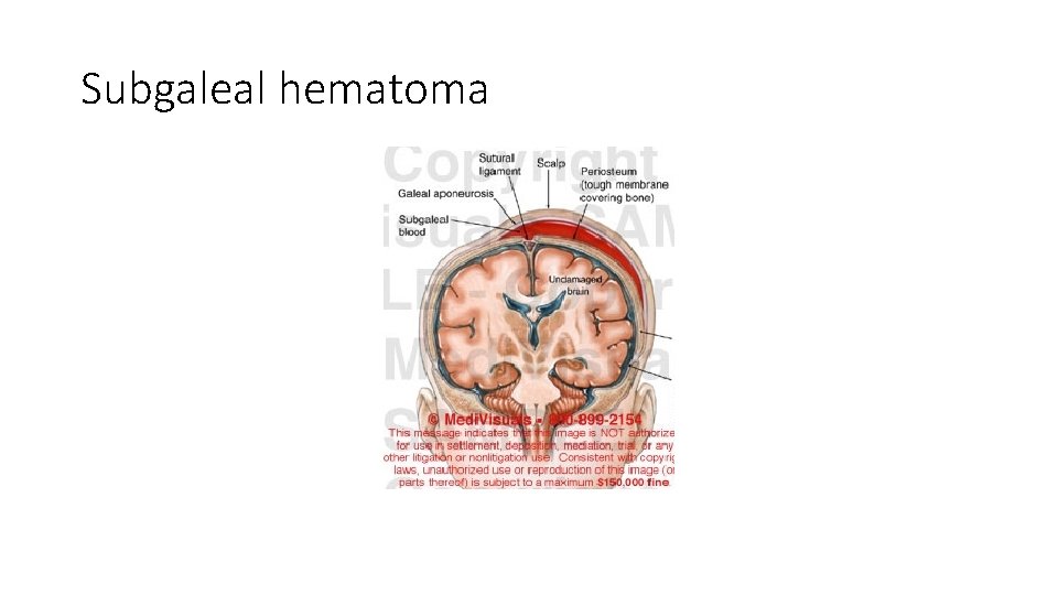 Head Injury Done By Mohammad Badwan Abdelrahman Bdeir