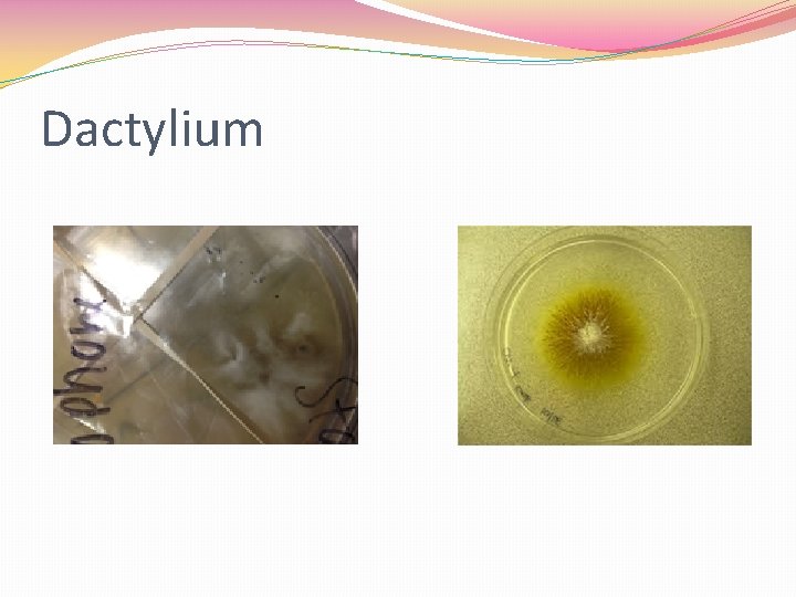 CDC Investigation Jesus Galan Hannah Van Dyke and