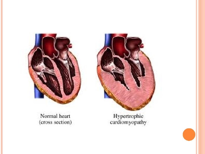 CHAPTER 5 Cardiovascular System WORD PARTS Cardo cardio