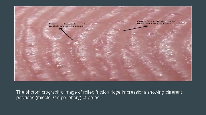 BASICS OF FINGERPRINTING SIGNIFICANCE OF POROSCOPY AND EDGEOSCOPY