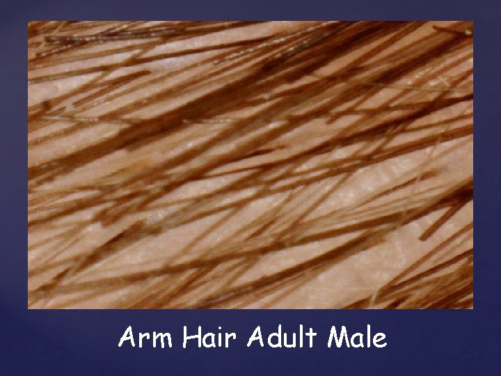 Hair Analysis Its Everywhere When is it used