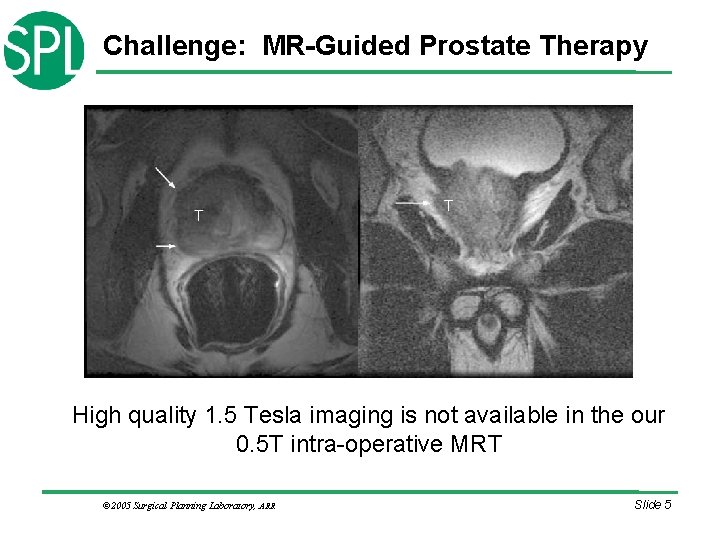 Prostate Image Processing Steven Haker Ph D 2005