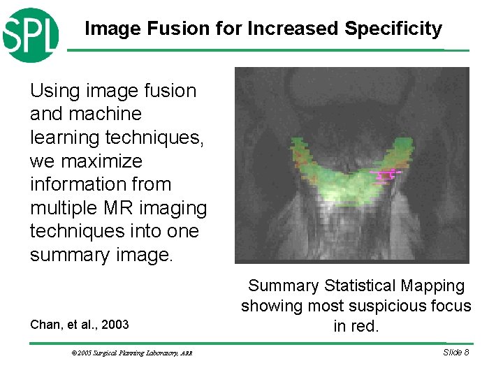 Prostate Image Processing Steven Haker Ph D 2005