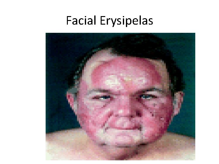 STREPTOCOCCI BY DR SB ZAILANI READERCONSULTANT CLINICAL MICROBIOLOGIST