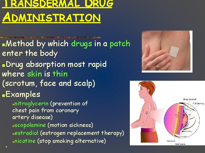 Sponge What is the difference between an ultrasound