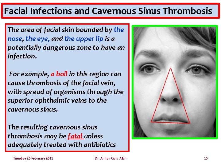 PERIPHERAL NERVOUS SYSTEM THE FACE Dr Aiman Qais