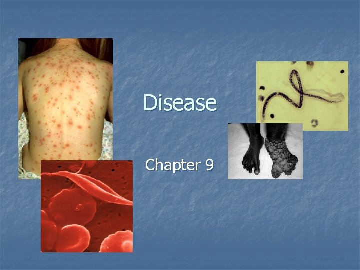Disease Chapter 9 Disease Defense and Human Health
