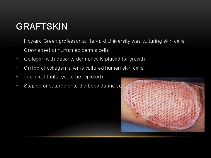 ARTIFICIAL SKIN Marc Cote BME 181 Section 2