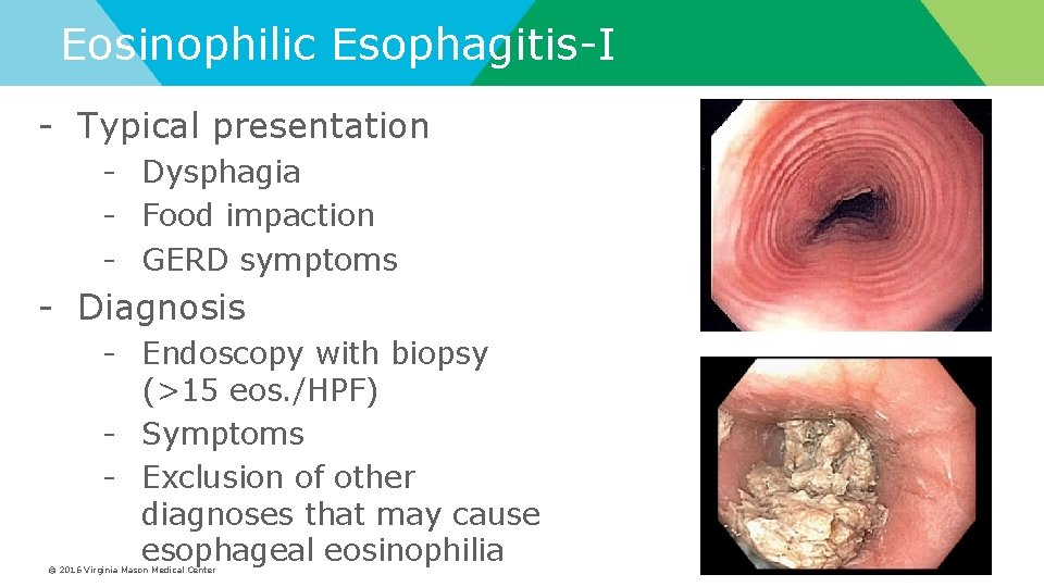 Esophageal Dysphagia Approach and Management Andrew S Ross