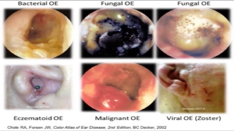 Common ENT diseases Prepared by dr Latifa Marie