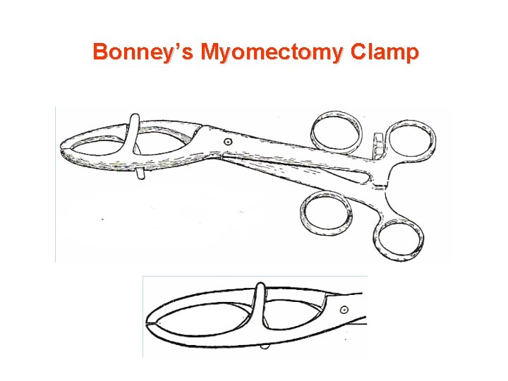 GYNECOLOGICAL INSTRUMENTS VAGINAL Speculums Cuscos vaginal speculum Sims