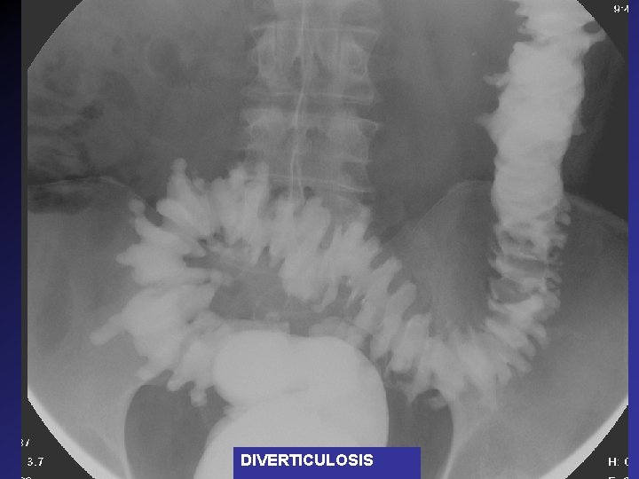 IMAGENOLOGA DEL SISTEMA DIGESTIVO II Dra Leticia Muoz