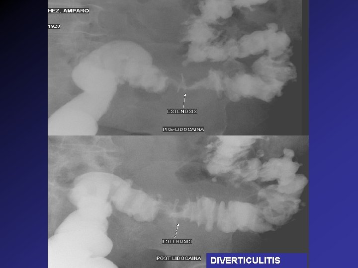 IMAGENOLOGA DEL SISTEMA DIGESTIVO II Dra Leticia Muoz