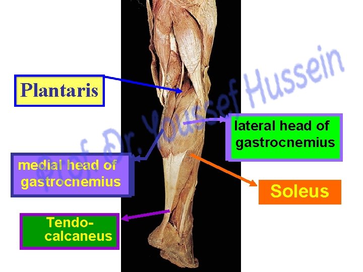 Posterior COMPARTMENTS OF THE LEG Posterior Compartment The