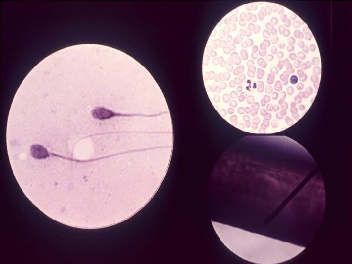 Forensic Serology Identification Using Bodily Fluids STEM Forensic