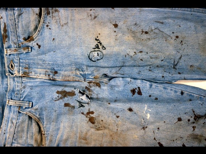 Forensic Serology Identification Using Bodily Fluids STEM Forensic