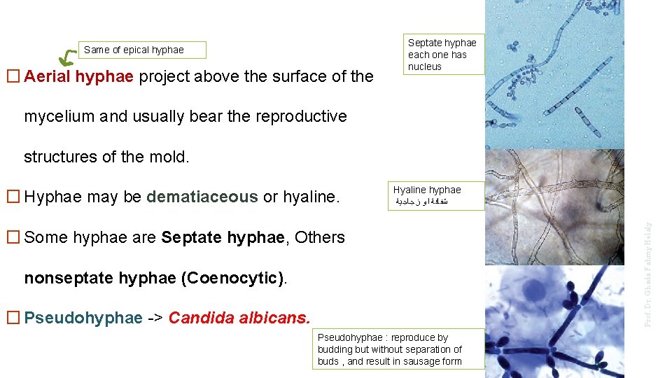 GENERAL MYCOLOGY BY Prof Dr Ghada Fahmy Helaly