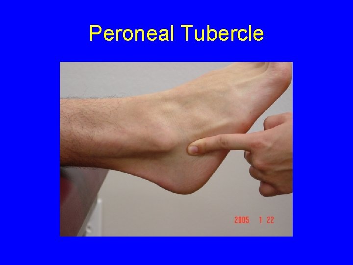 Foot Surface Anatomy Bony Palpation Medial Aspect Medial