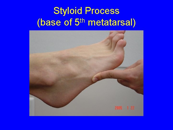 Foot Surface Anatomy Bony Palpation Medial Aspect Medial