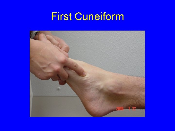 Foot Surface Anatomy Bony Palpation Medial Aspect Medial