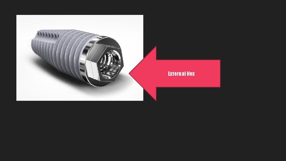 Design Consideration for Implant Restoration By Dr Beatrice