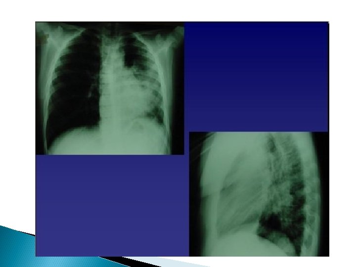 UNIDAD 3 ANATOMIA DE LA VIA DIGESTIVA ESTUDIOS