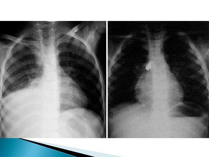 UNIDAD 3 ANATOMIA DE LA VIA DIGESTIVA ESTUDIOS