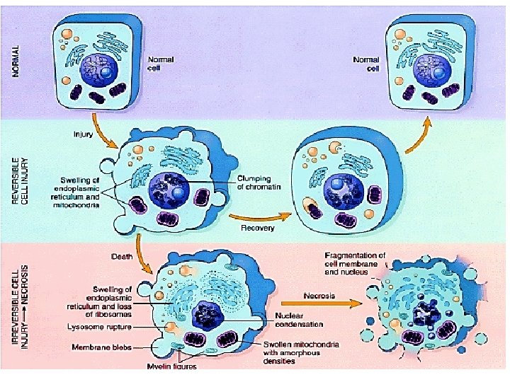 MEKANISME KEMATIAN JARINGAN DAN NEKROSIS DALAM SEL KEMATIAN
